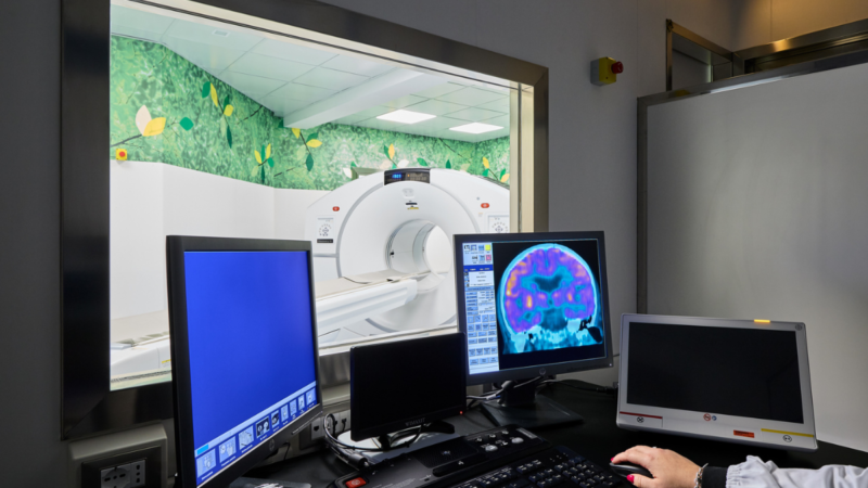 Pet Tc Total body: l’esame più preciso per diagnosticare i tumori.